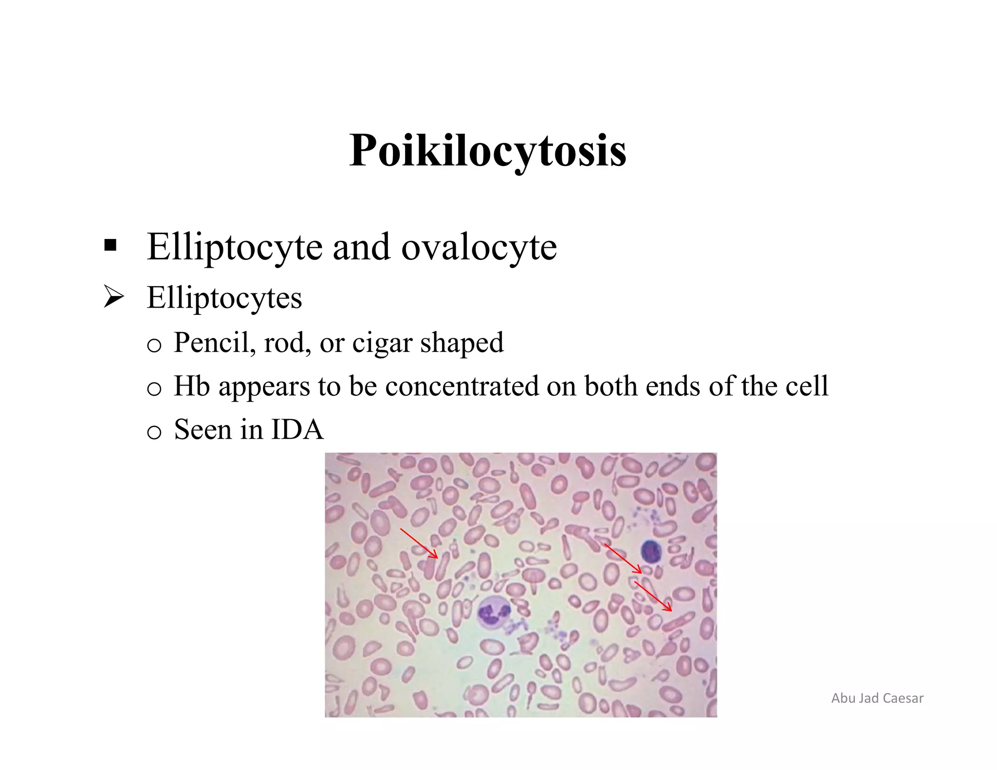 Blood film preparation and reporting | PDF
