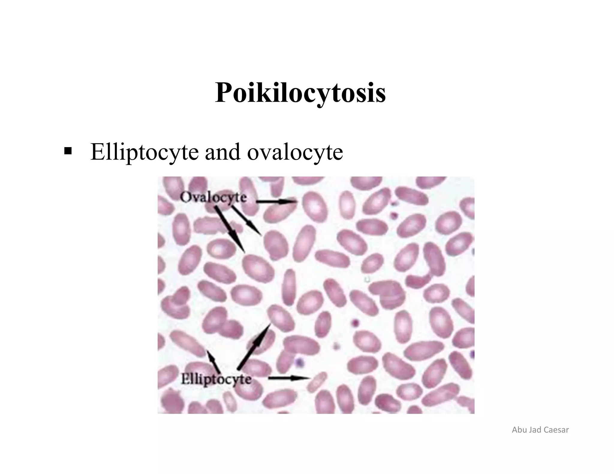 Blood film preparation and reporting | PDF