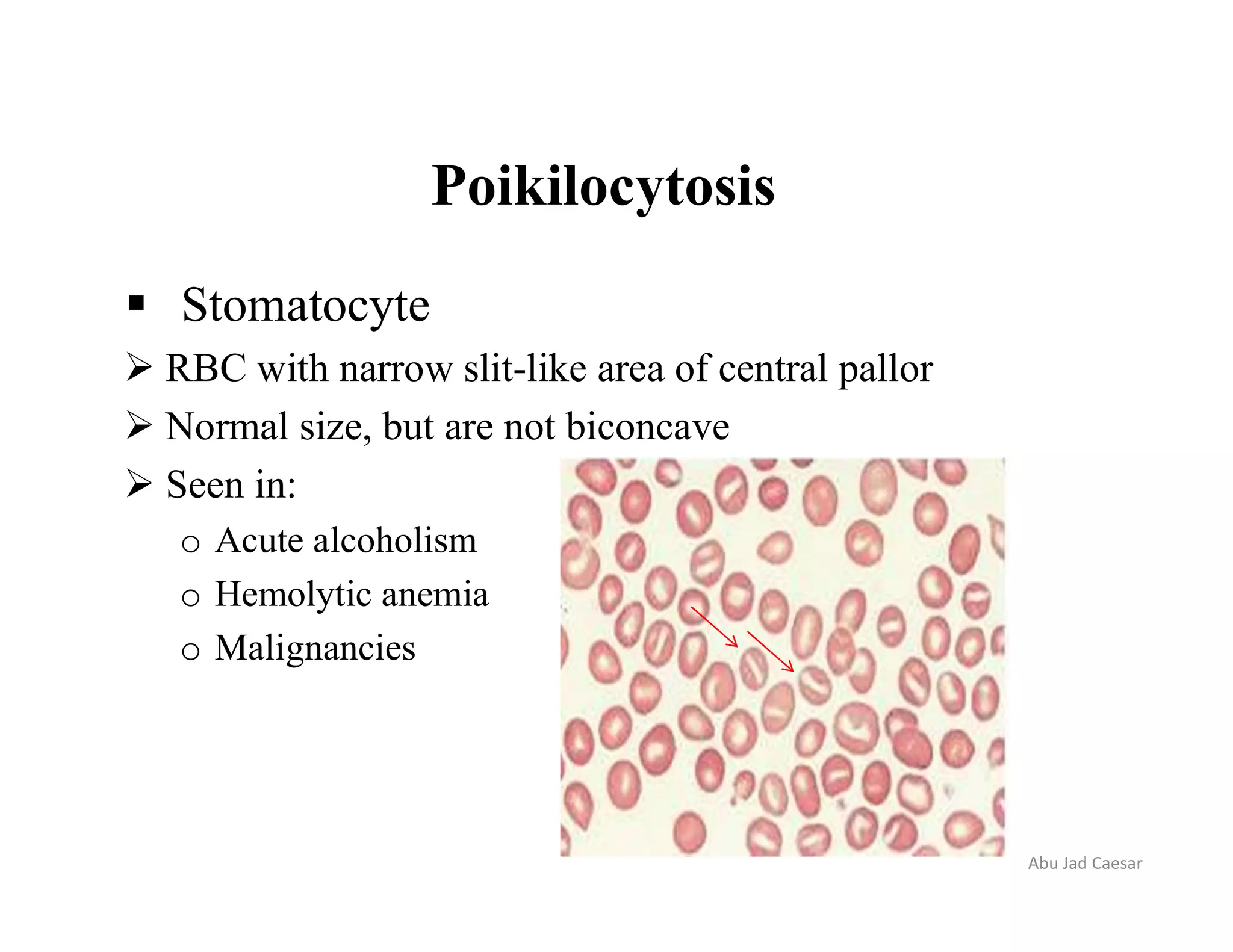 Blood film preparation and reporting | PDF