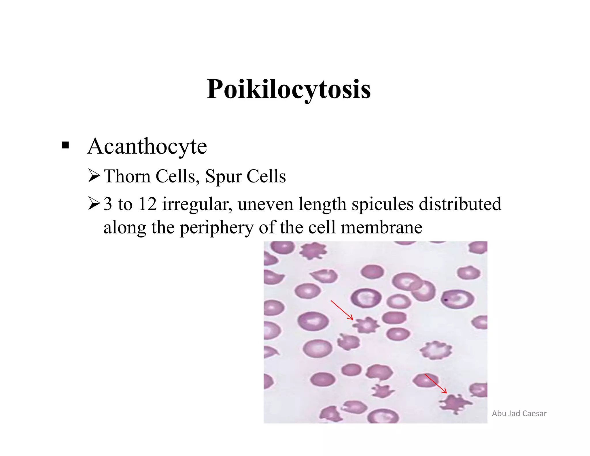 Blood film preparation and reporting | PDF