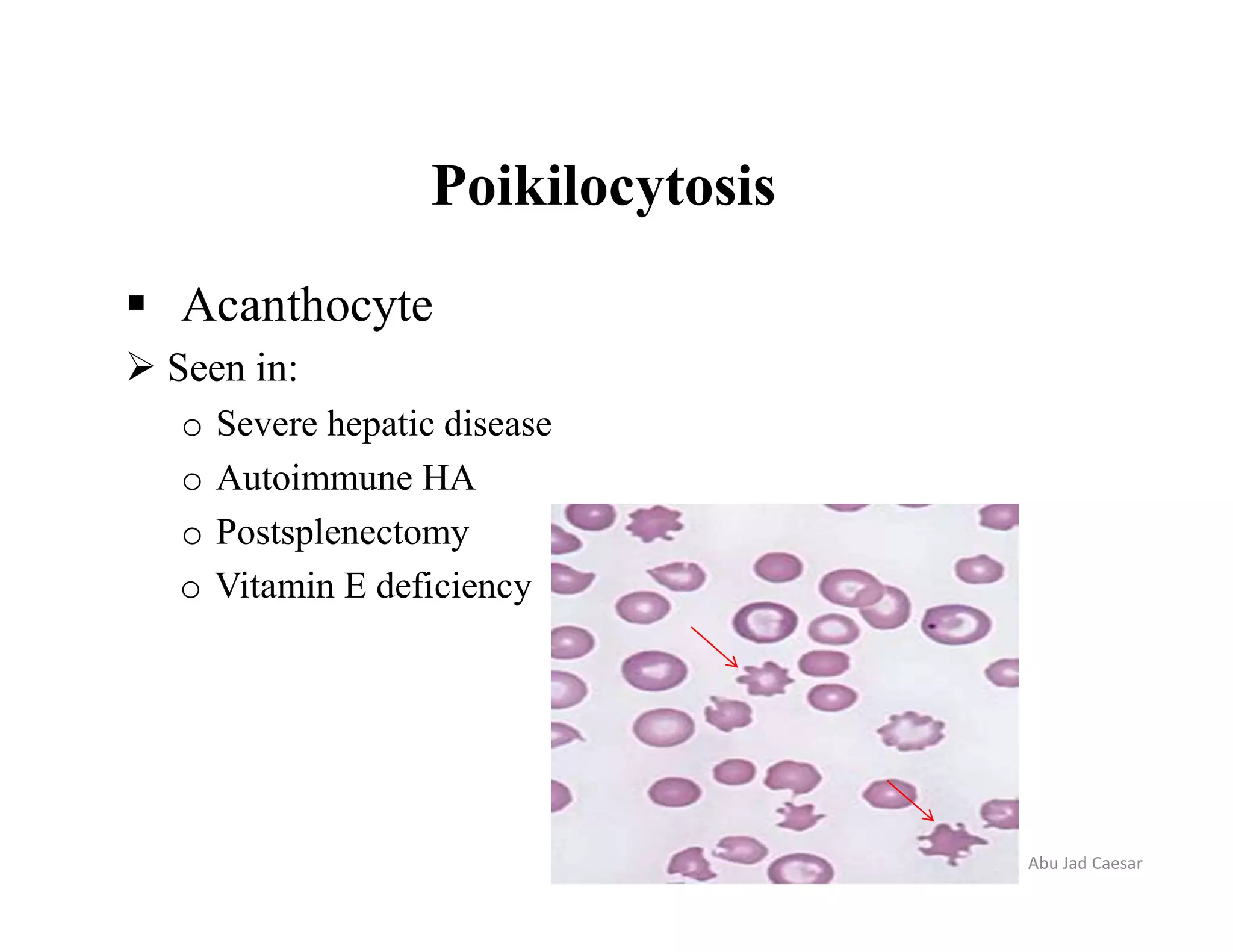 Blood film preparation and reporting | PDF