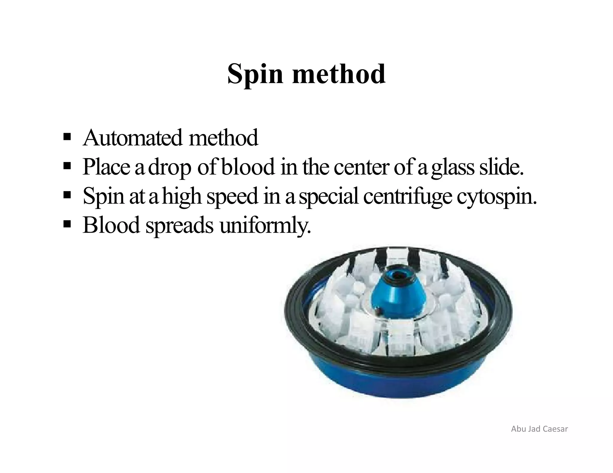 Blood film preparation and reporting | PDF