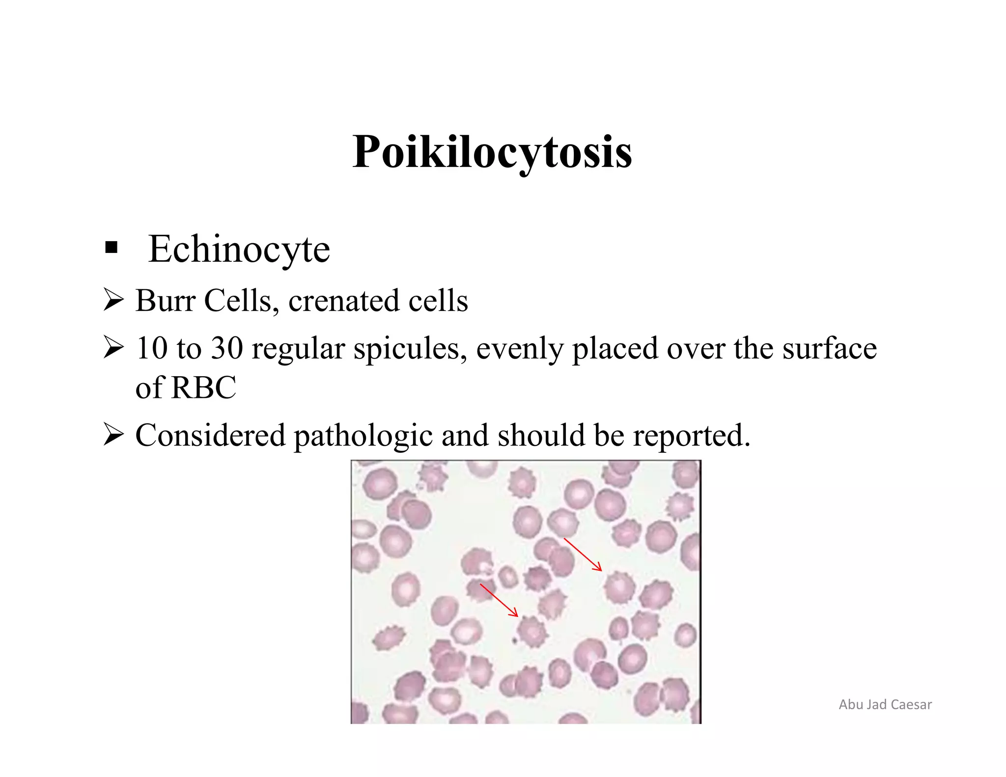 Blood film preparation and reporting | PDF