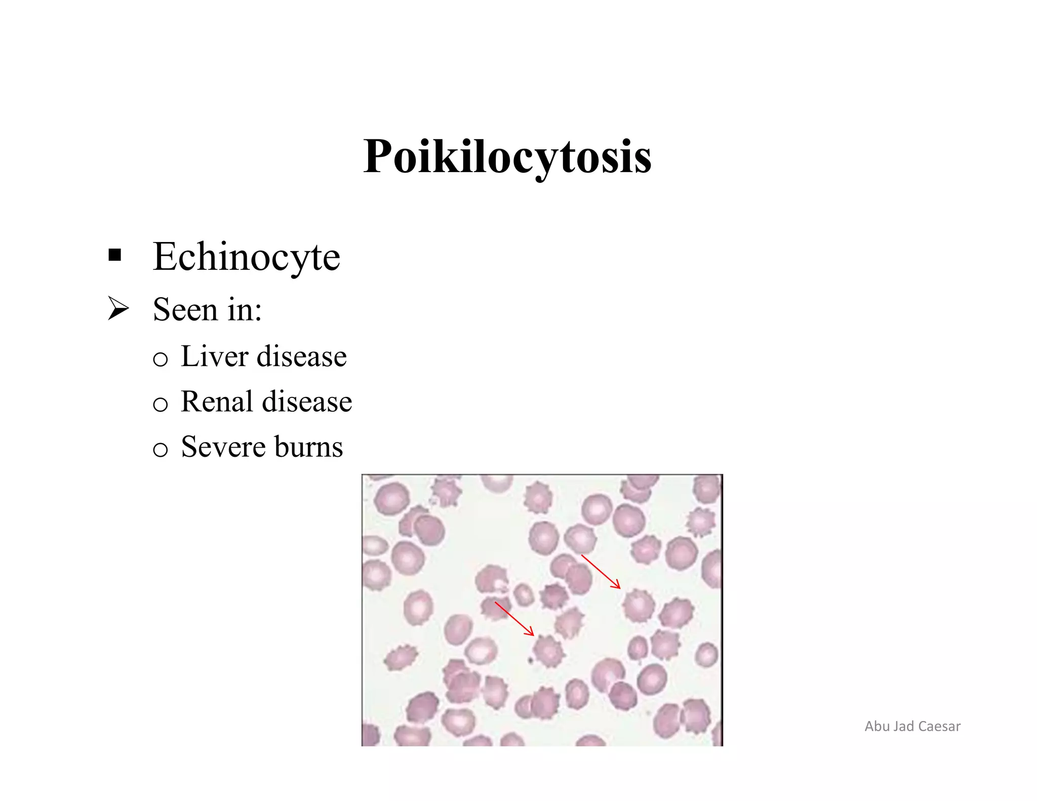 Blood film preparation and reporting | PDF