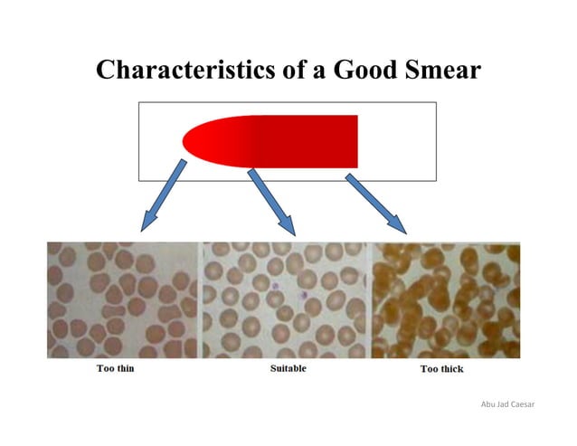 Blood film preparation and reporting | PDF