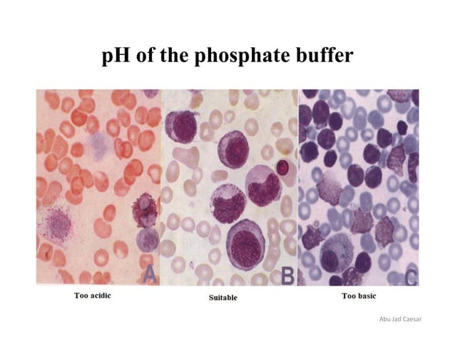 Blood film preparation and reporting | PDF