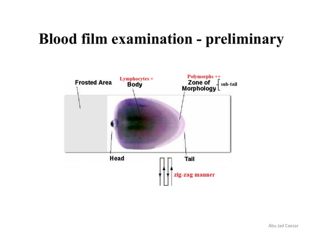 Blood film preparation and reporting | PDF