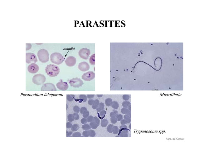 Blood film preparation and reporting | PDF