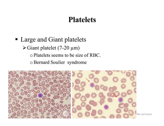 Blood film preparation and reporting | PDF