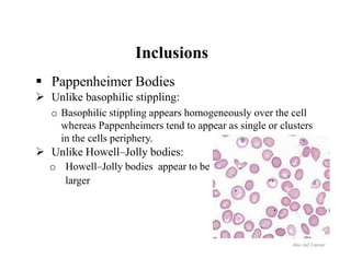 Blood film preparation and reporting | PDF