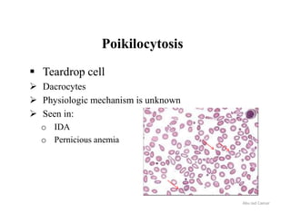 Blood film preparation and reporting | PDF