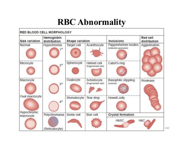 Blood film preparation and reporting