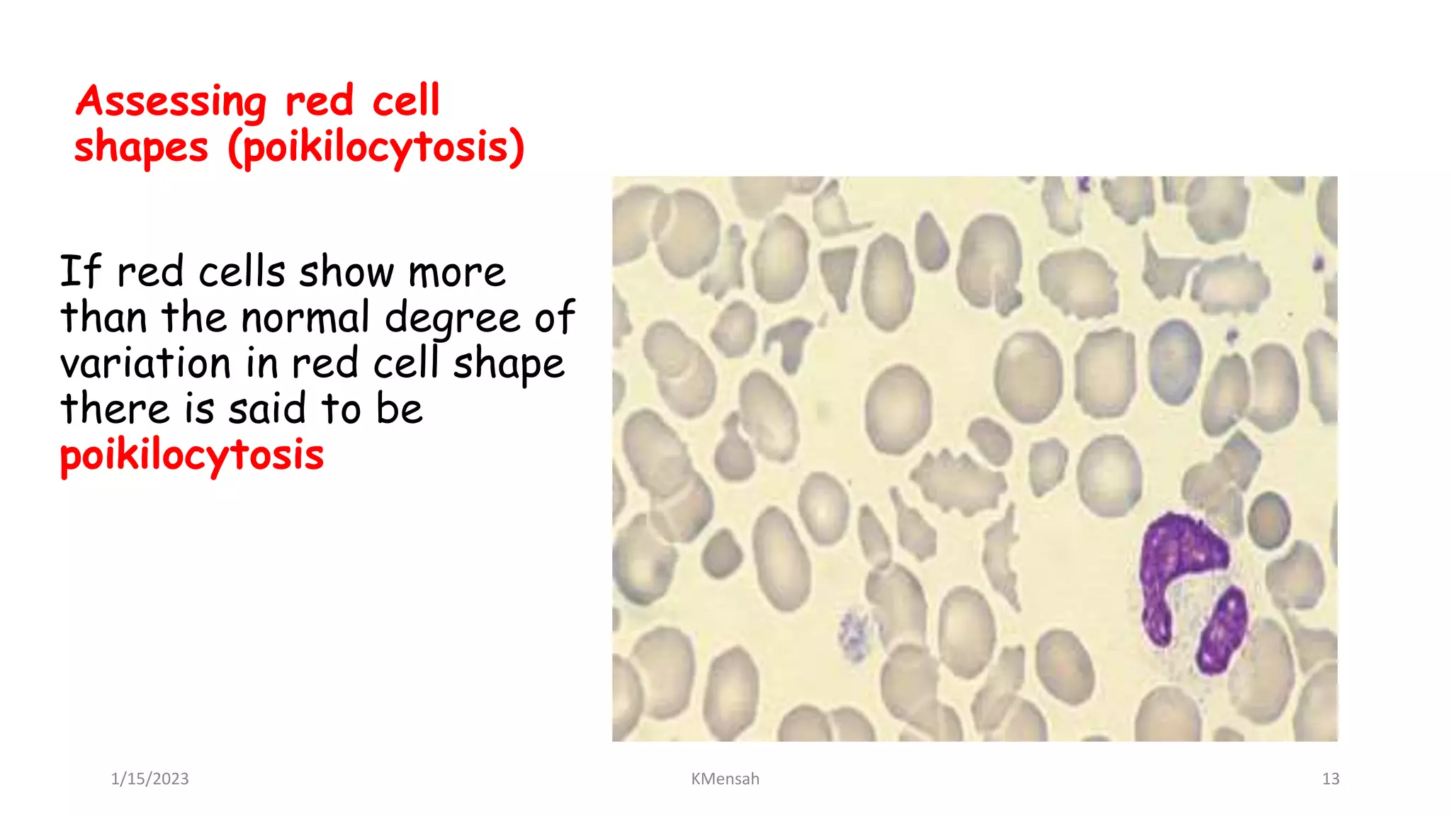 BLOOD FILM COMMENT part one.pptx