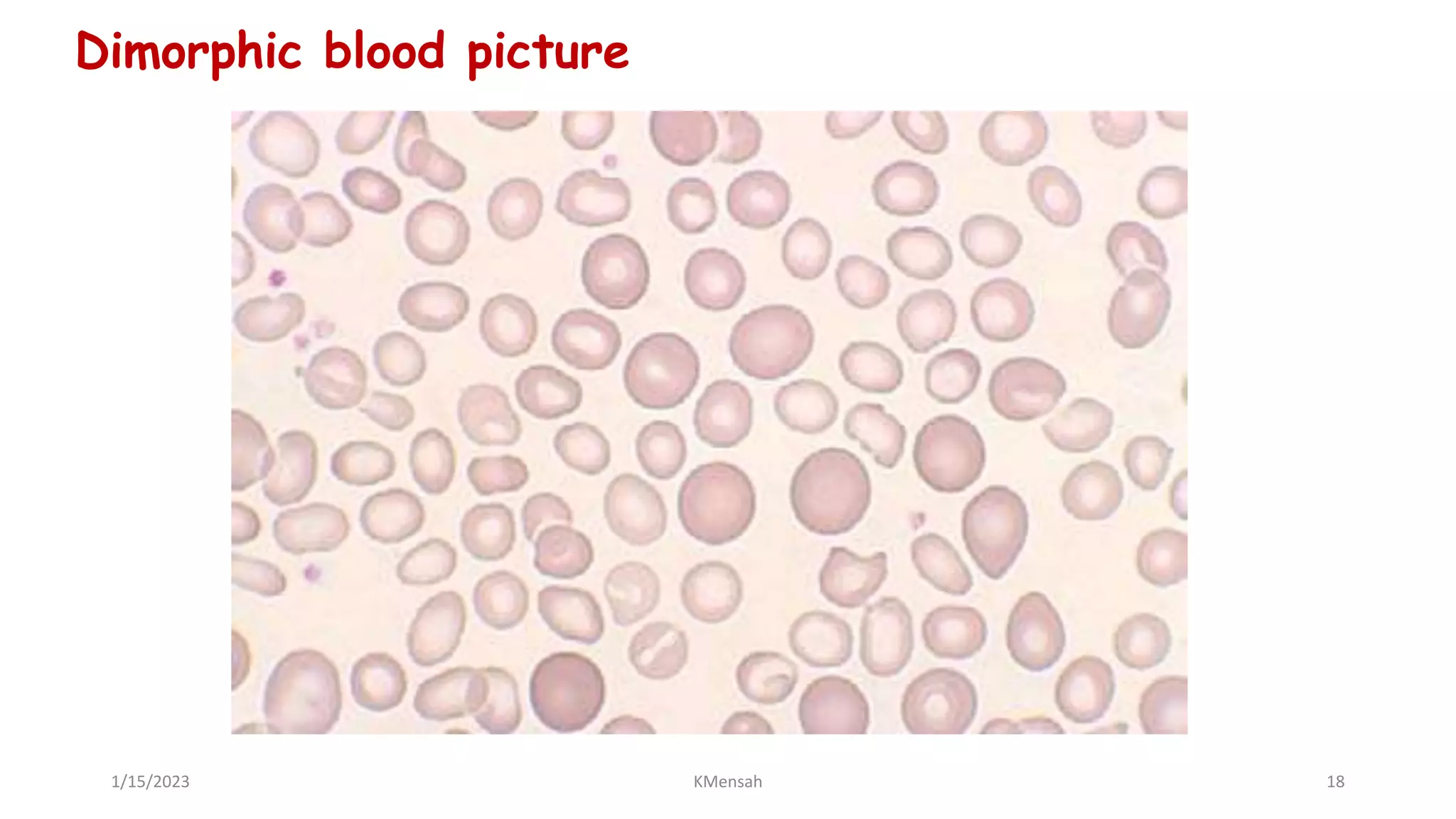 BLOOD FILM COMMENT part one.pptx