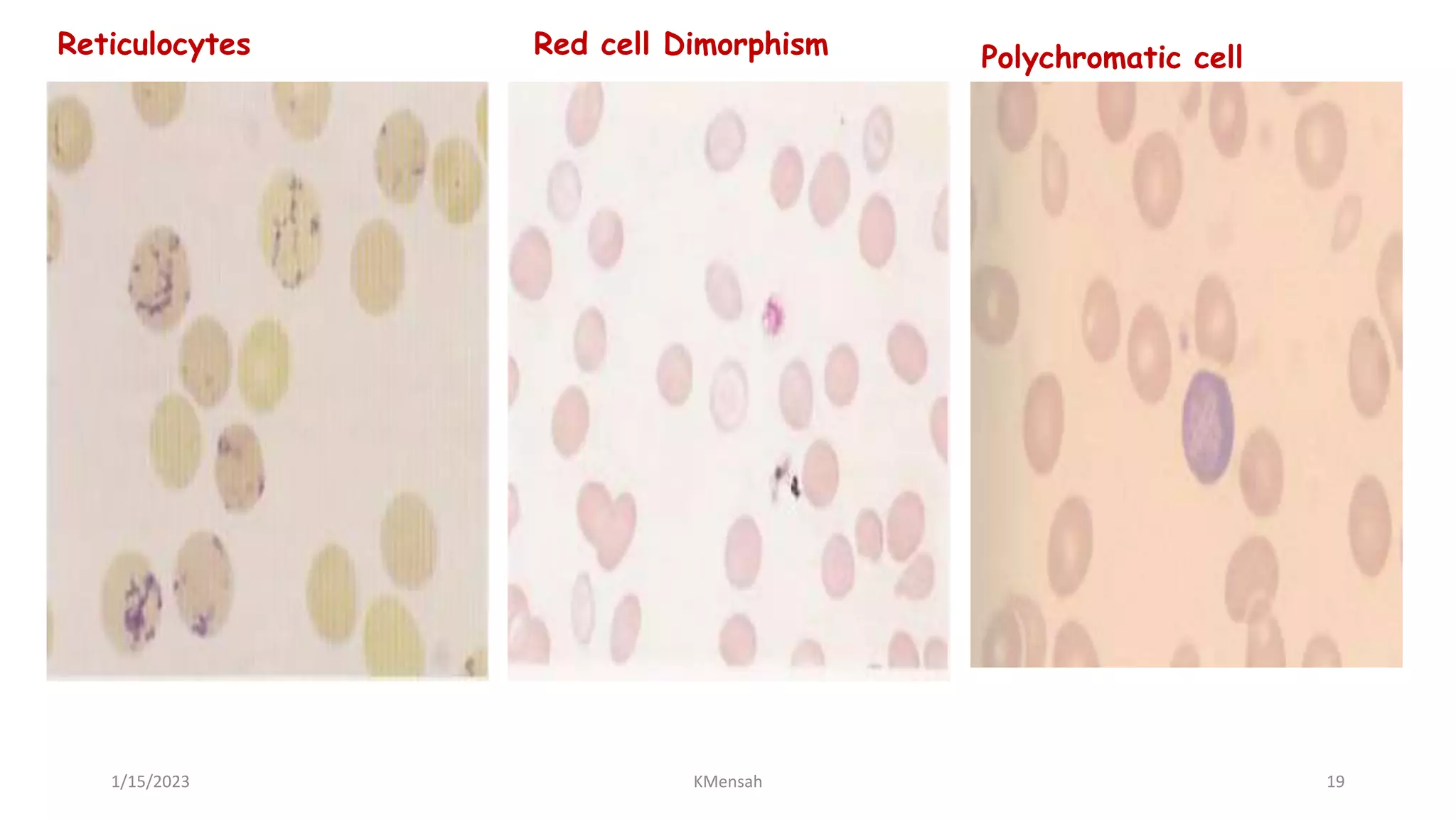 BLOOD FILM COMMENT part one.pptx