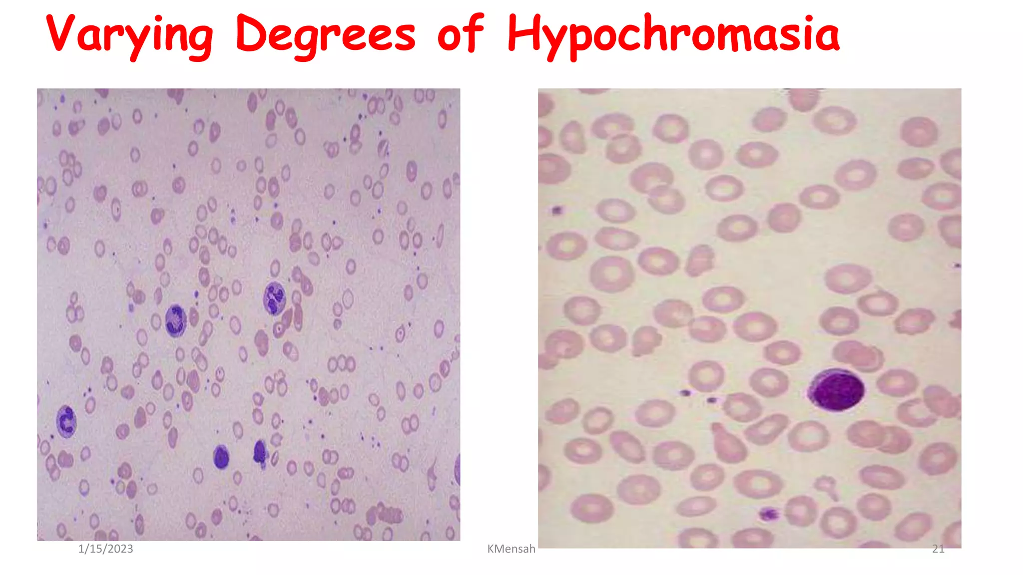 BLOOD FILM COMMENT part one.pptx