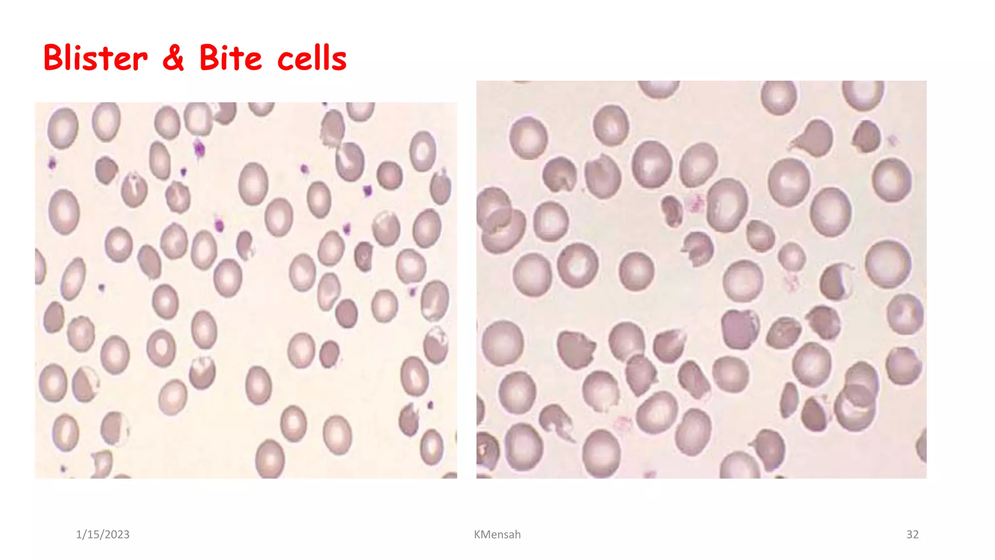 BLOOD FILM COMMENT part one.pptx