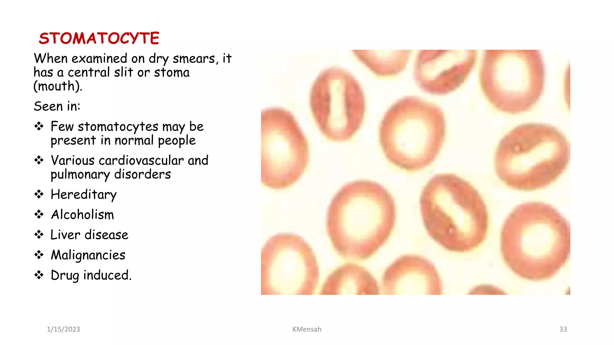 BLOOD FILM COMMENT part one.pptx