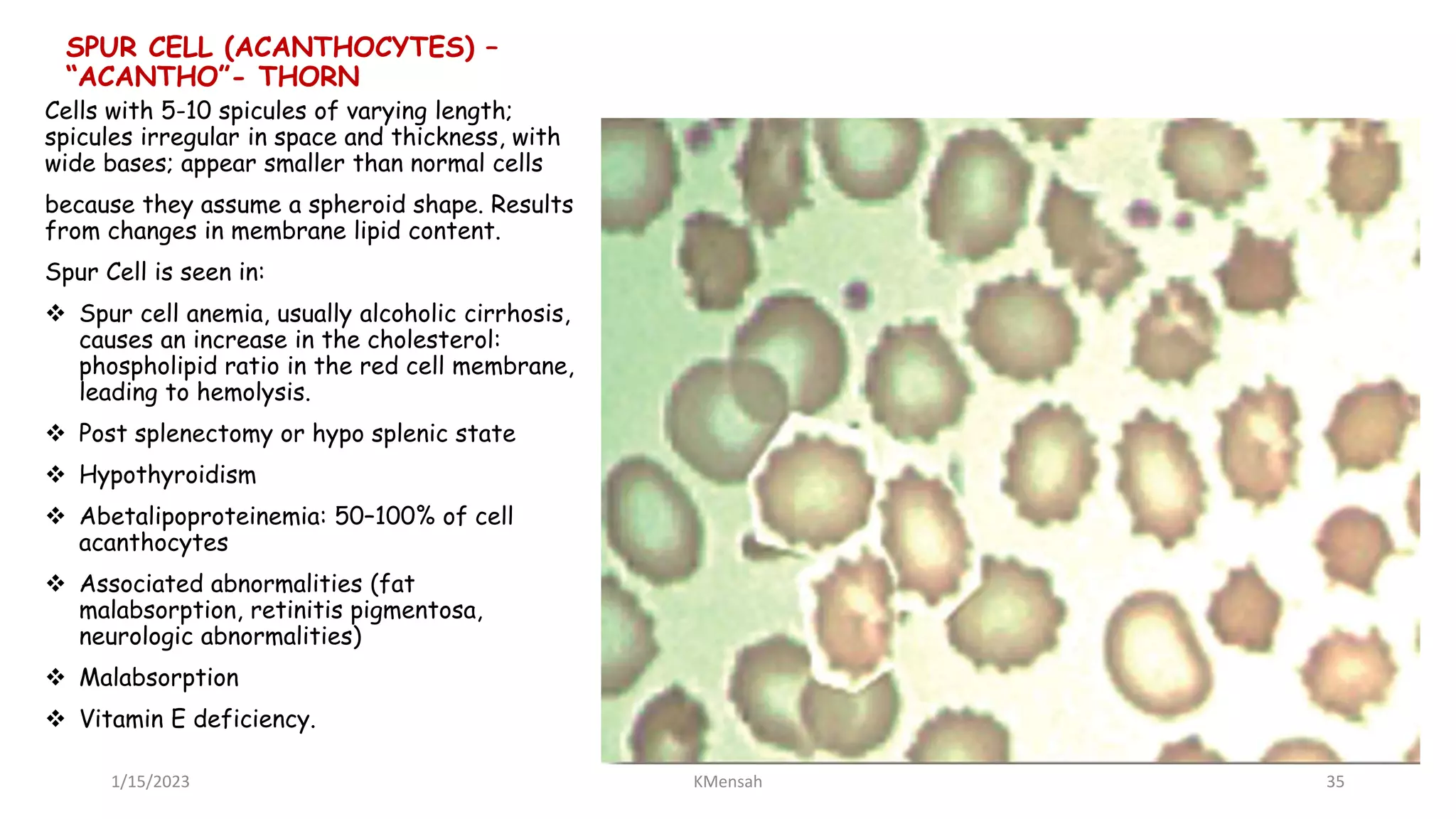 BLOOD FILM COMMENT part one.pptx