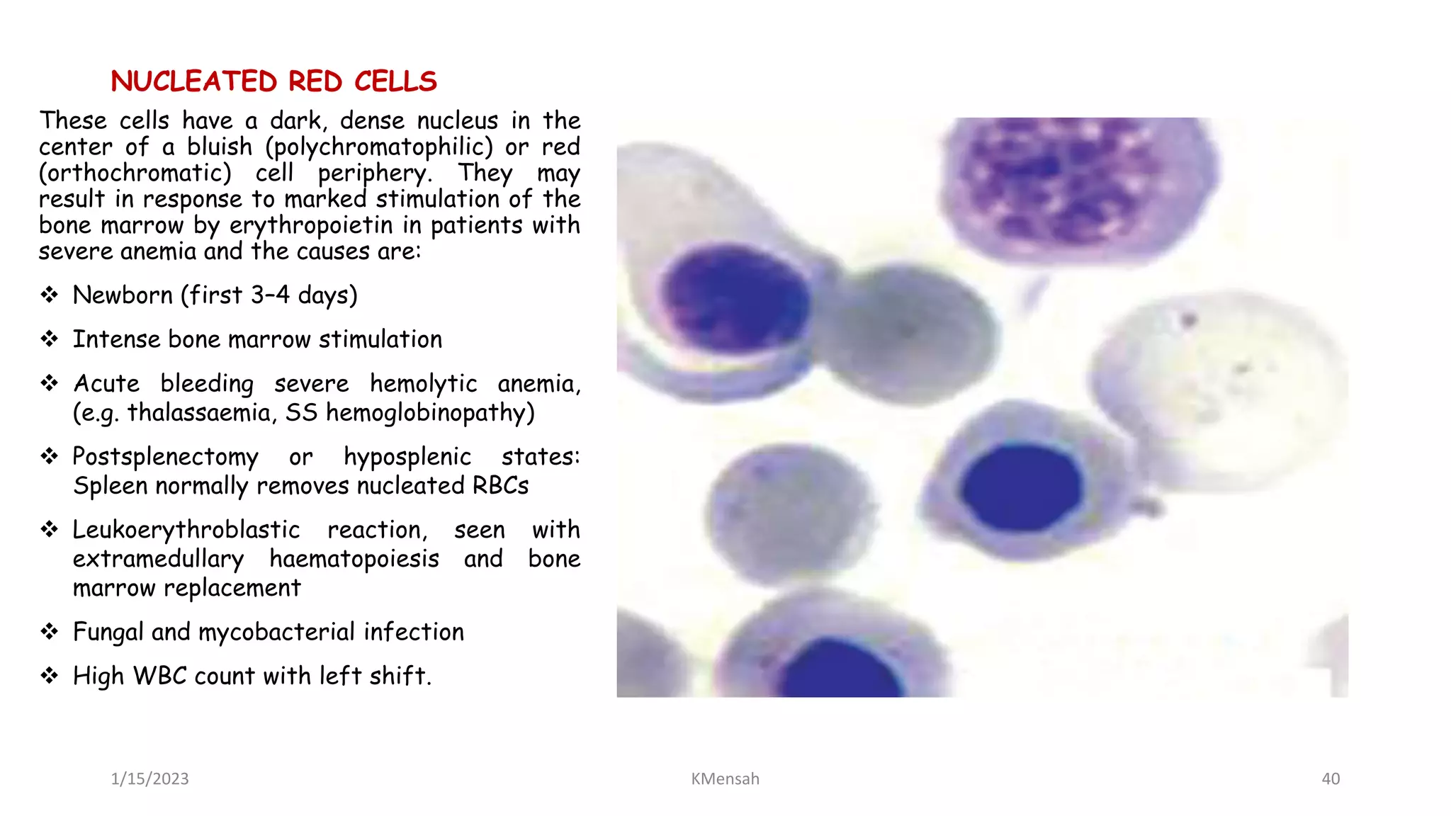 BLOOD FILM COMMENT part one.pptx