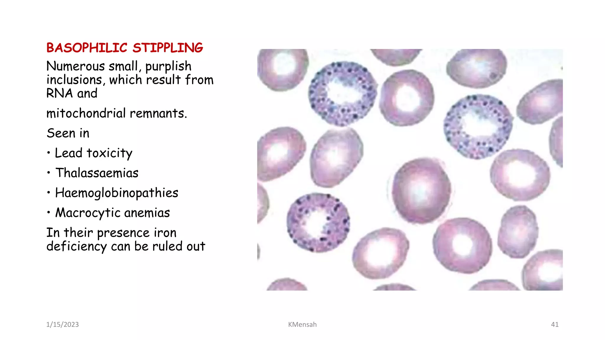 BLOOD FILM COMMENT part one.pptx