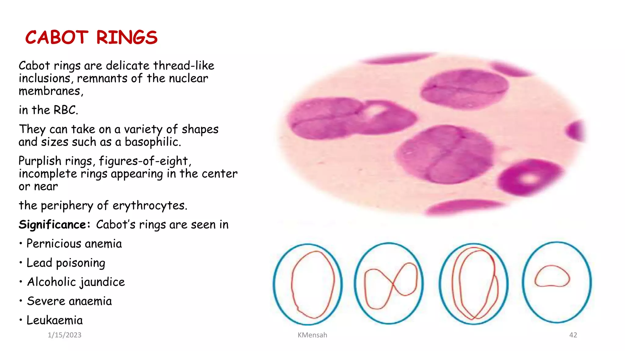 BLOOD FILM COMMENT part one.pptx