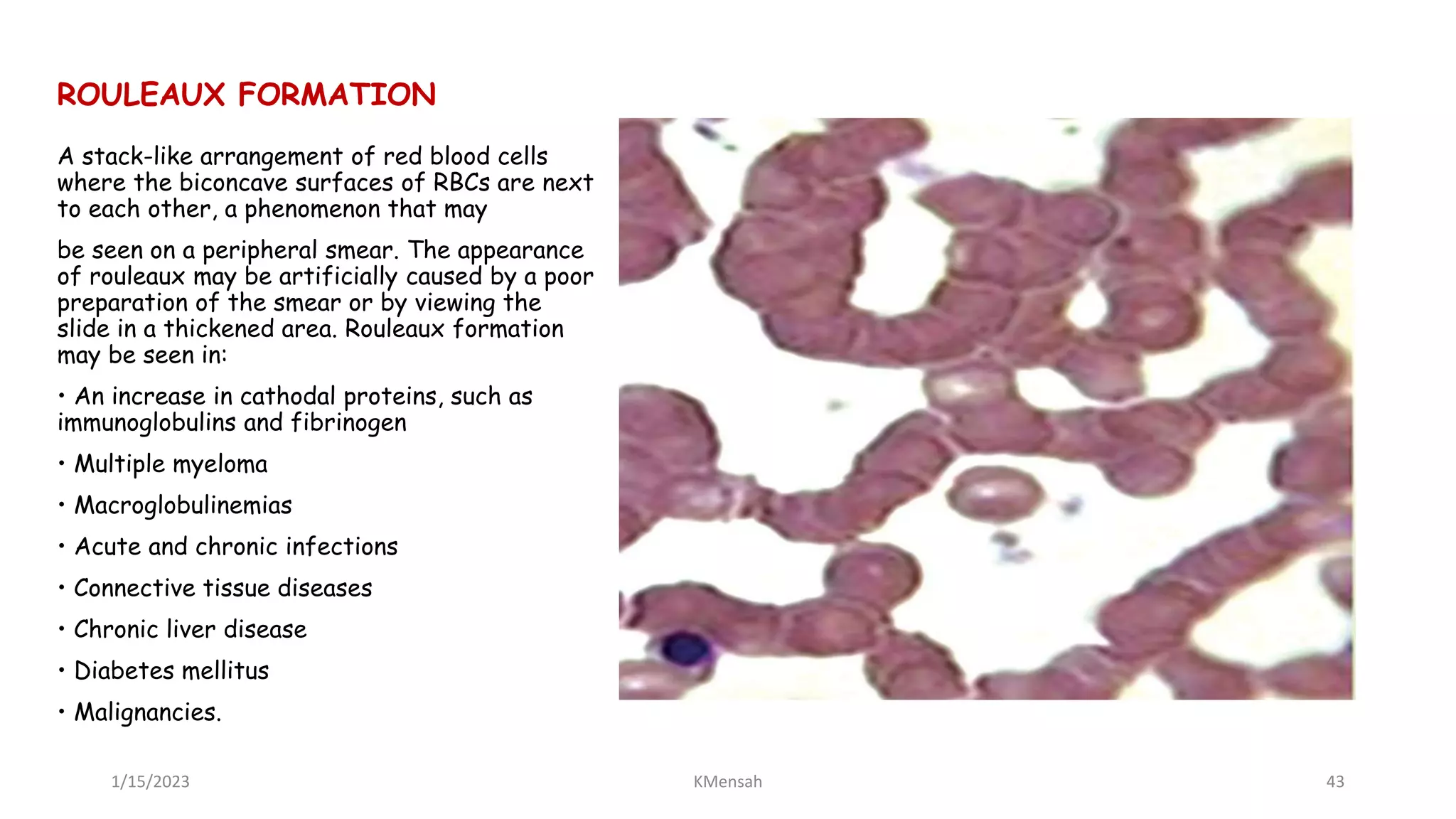 BLOOD FILM COMMENT part one.pptx