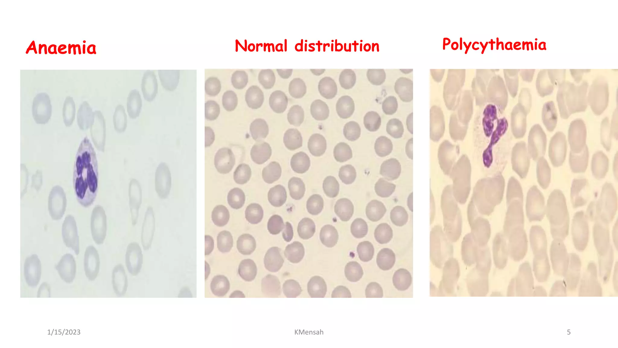 BLOOD FILM COMMENT part one.pptx