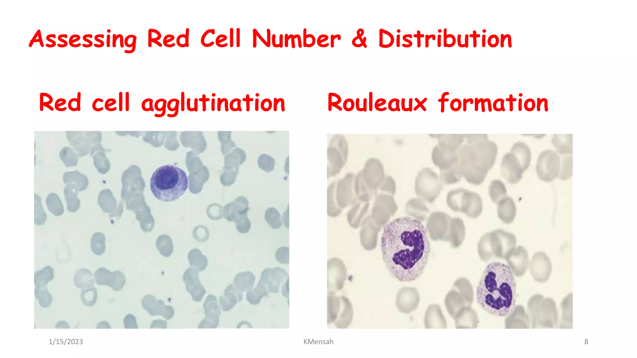 BLOOD FILM COMMENT part one.pptx