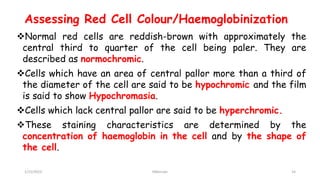 BLOOD FILM COMMENT part one.pptx