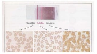 BLOOD FILM COMMENT part one.pptx