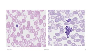 BLOOD FILM COMMENT part one.pptx