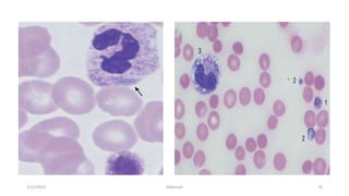 BLOOD FILM COMMENT part one.pptx