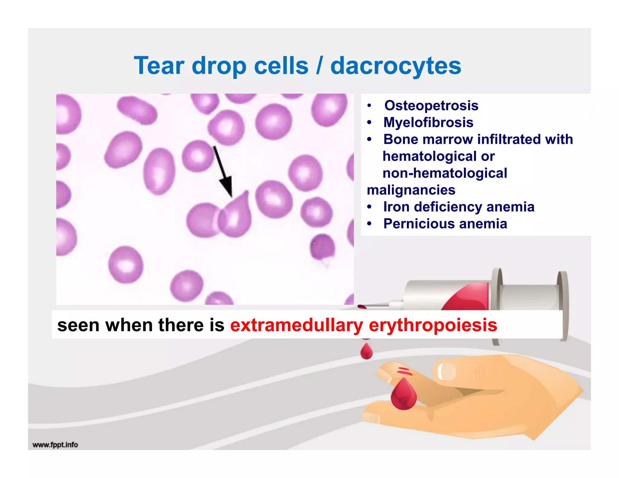 Blood film examination | PDF