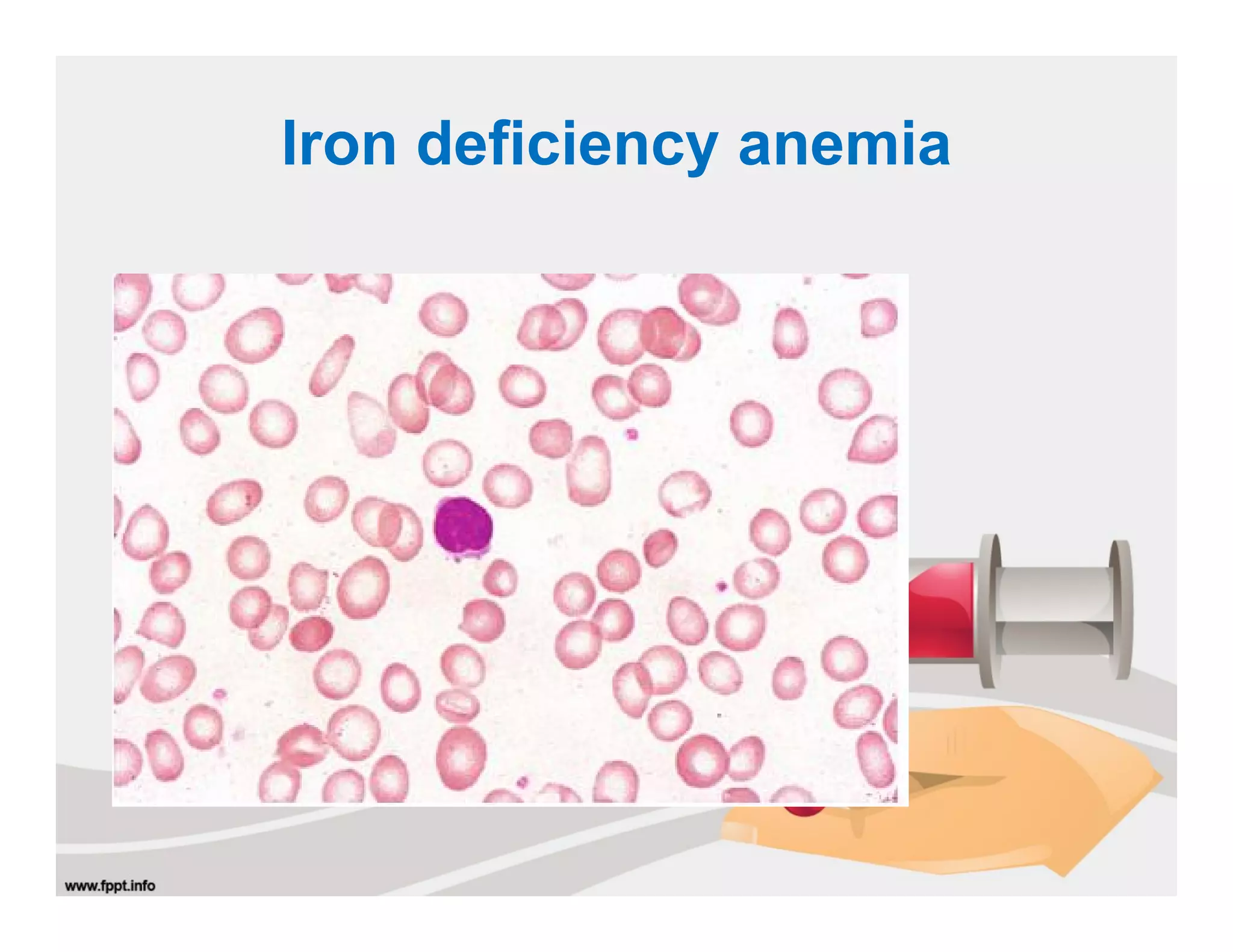 Blood film examination | PDF