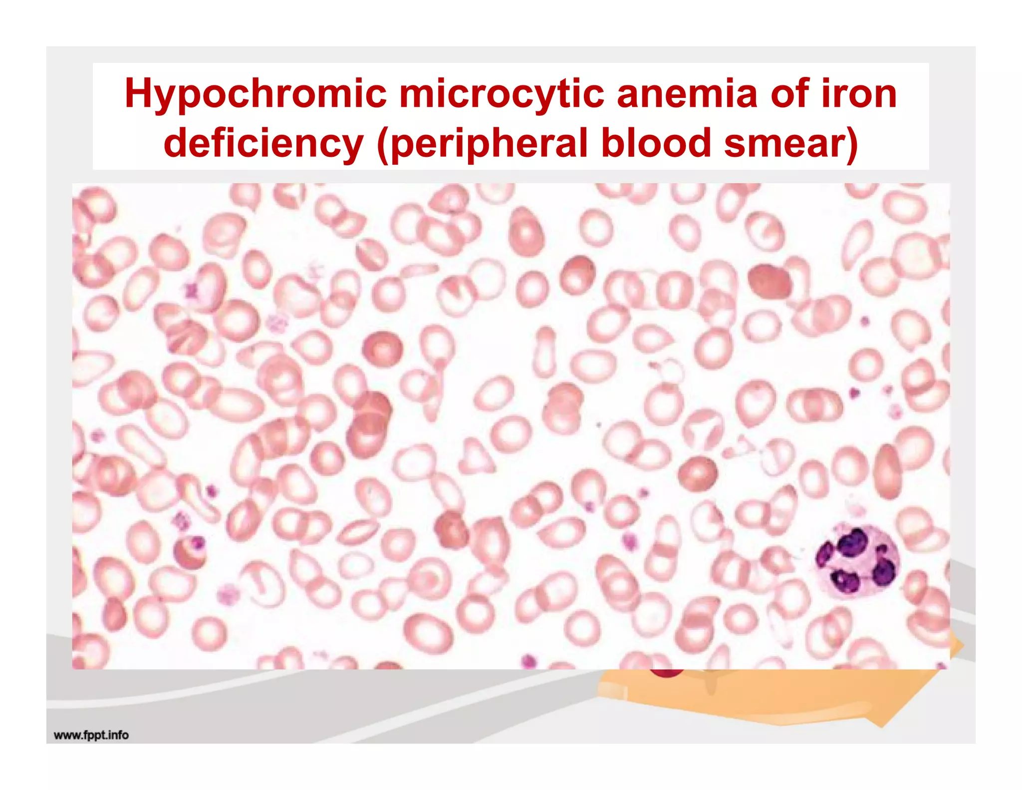 Blood film examination | PDF