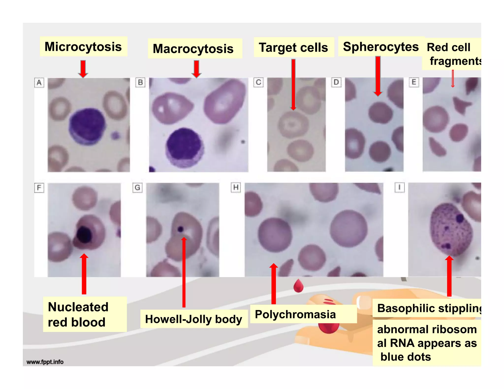 Blood film examination | PDF