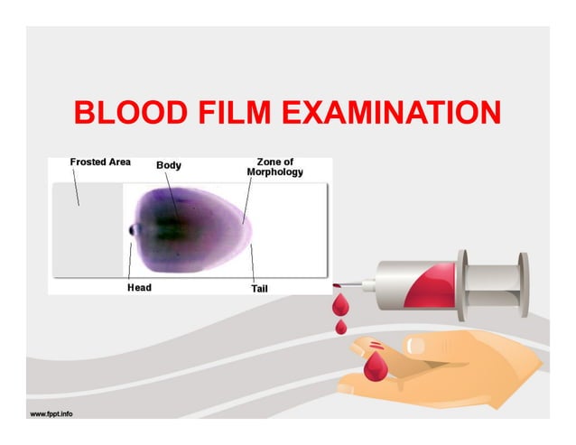 Blood film examination | PDF | Blood Disorders | Diseases and Conditions