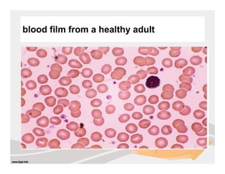 Blood film examination | PDF