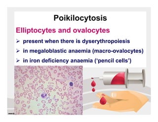 Blood film examination | PDF