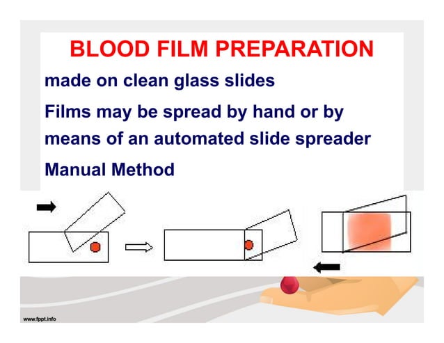 Blood film examination | PDF | Blood Disorders | Diseases and Conditions