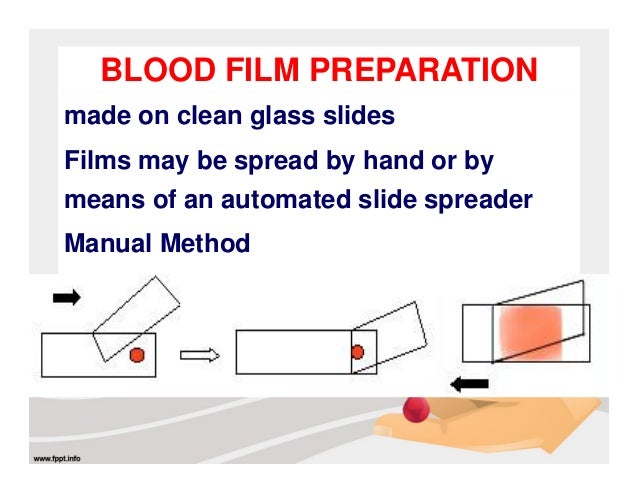 Blood film examination