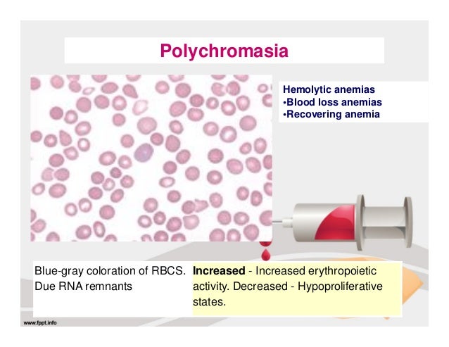 Blood film examination