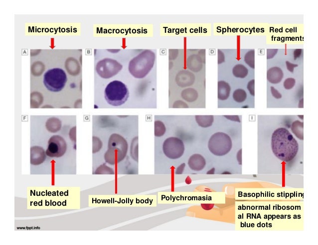 Blood Film Examination Blood Film Examination