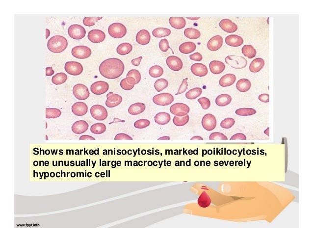 Blood film examination