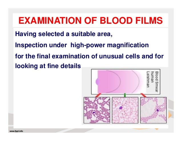 Blood film examination