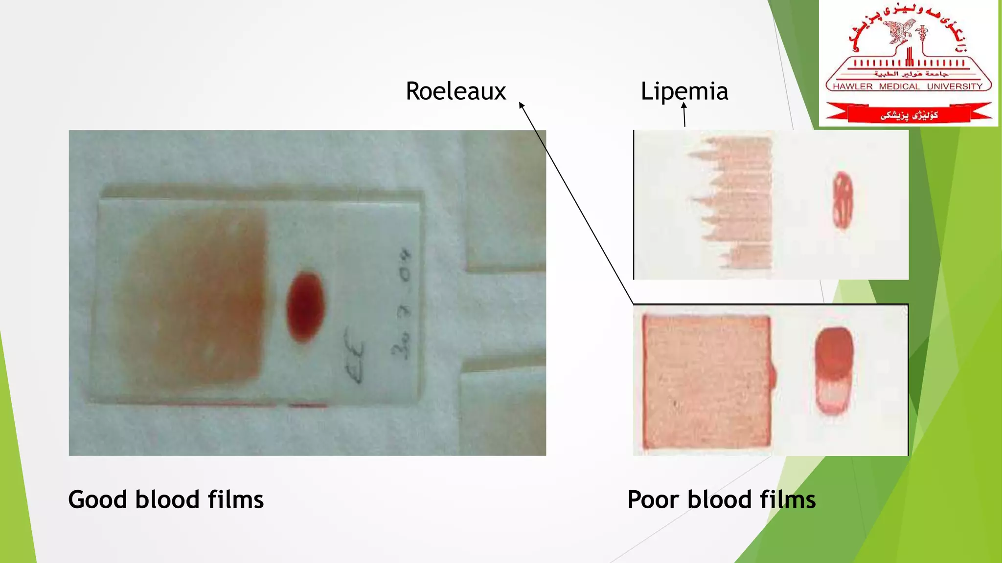 Blood film for malaria | PPTX