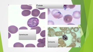 Blood film for malaria | PPTX