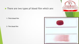 Blood film for malaria | PPTX