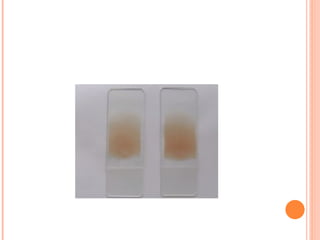 Blood Film Preparation and Staining preparation | PPTX